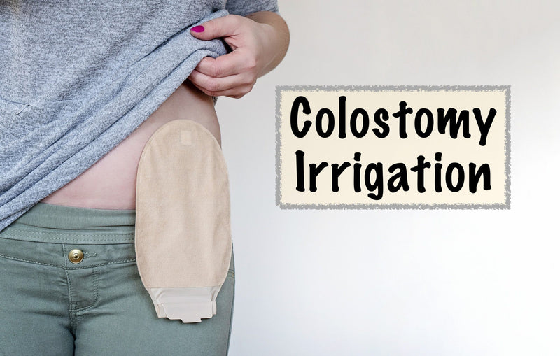 Sigmoid Colostomy Irrigation